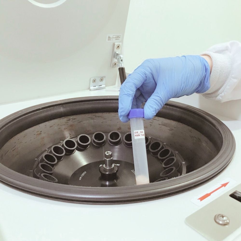 CRONIC-DSP Project Advances in Assessing Marine Toxins' Effects - CIFGA